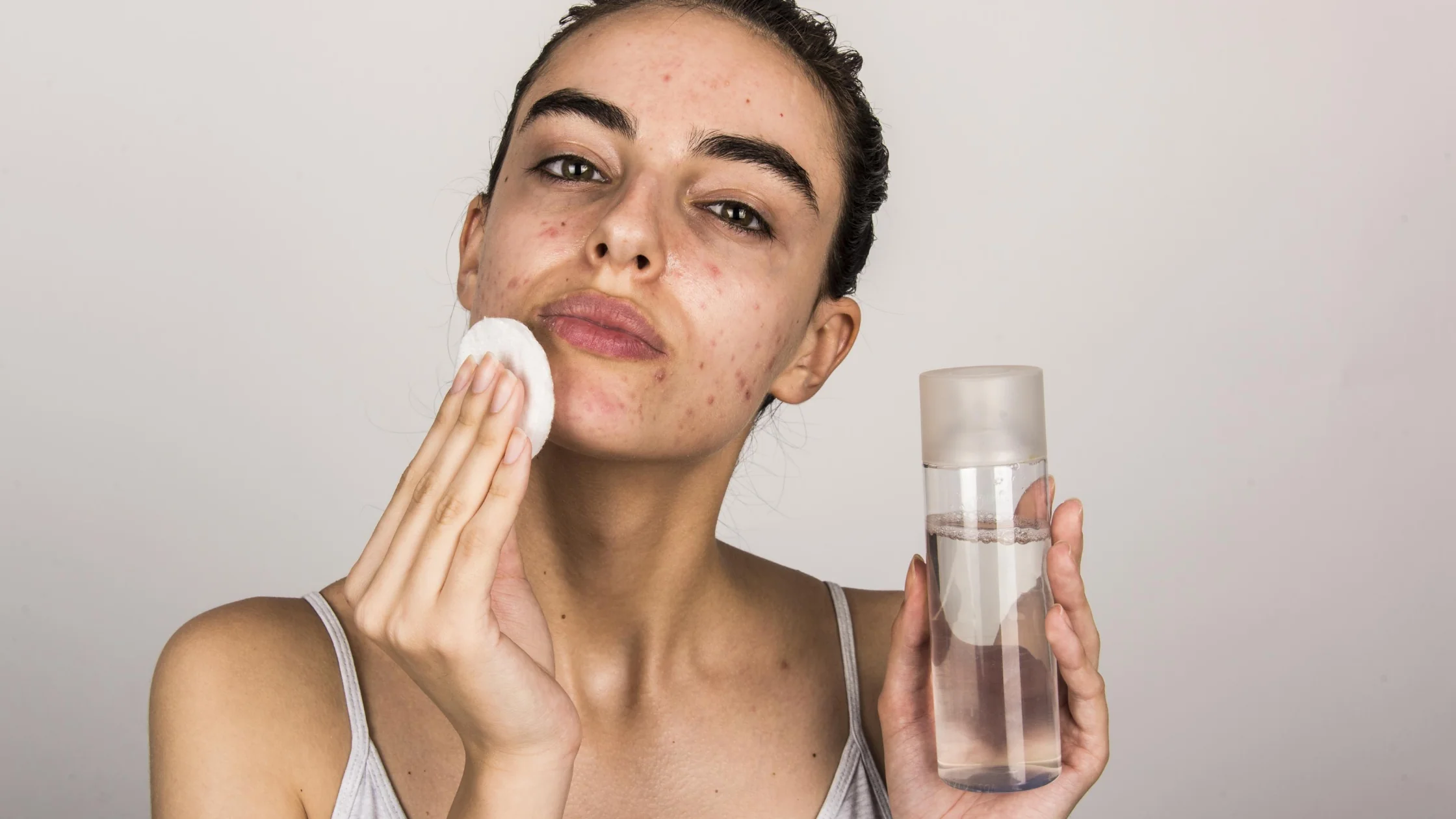 How to create a skincare routine for acne prone skin | Always Flaunt ...